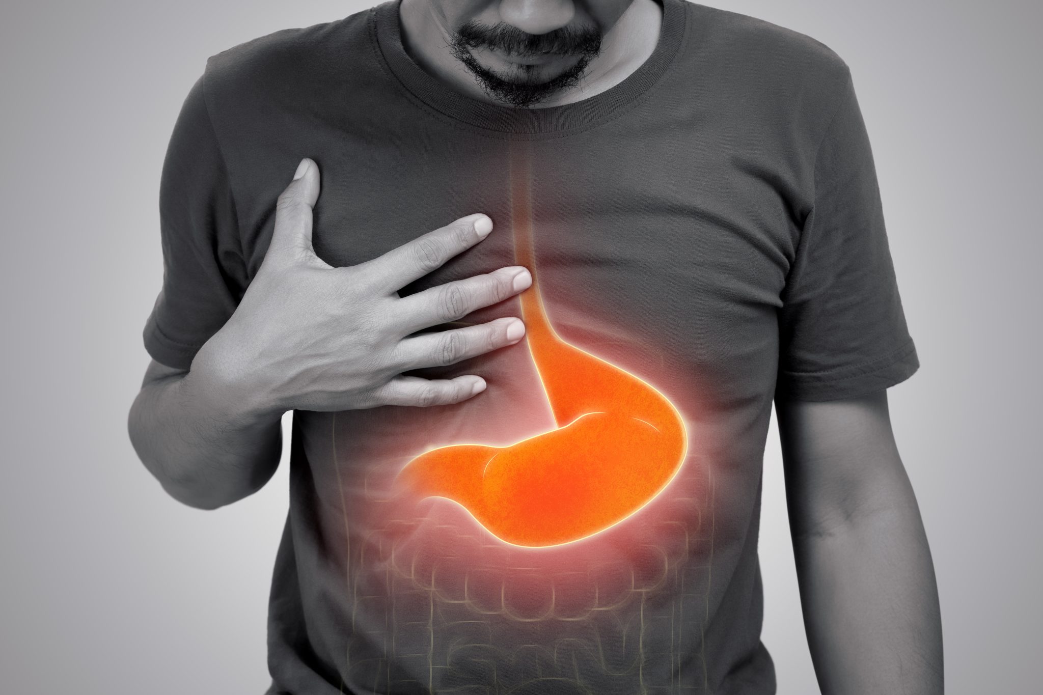 Ph-And-Impedance-Test-For-Dyspepsia | London Gastro Care